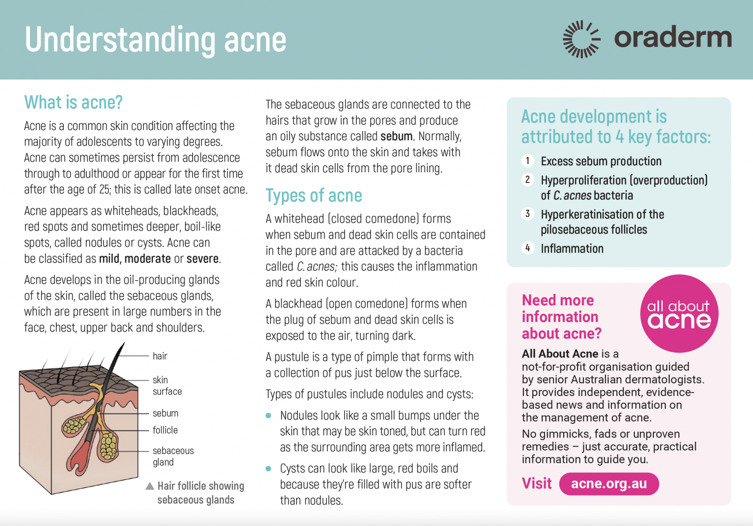 Types Of Acne - Types of Pimples - All About Acne